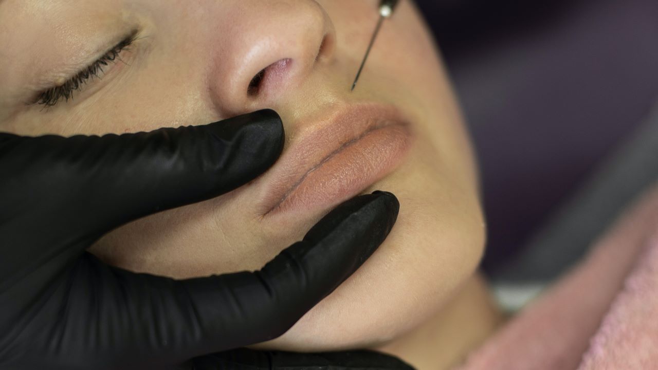 Comparing Aesthetic Technologies: RF Microneedling vs. Traditional ...