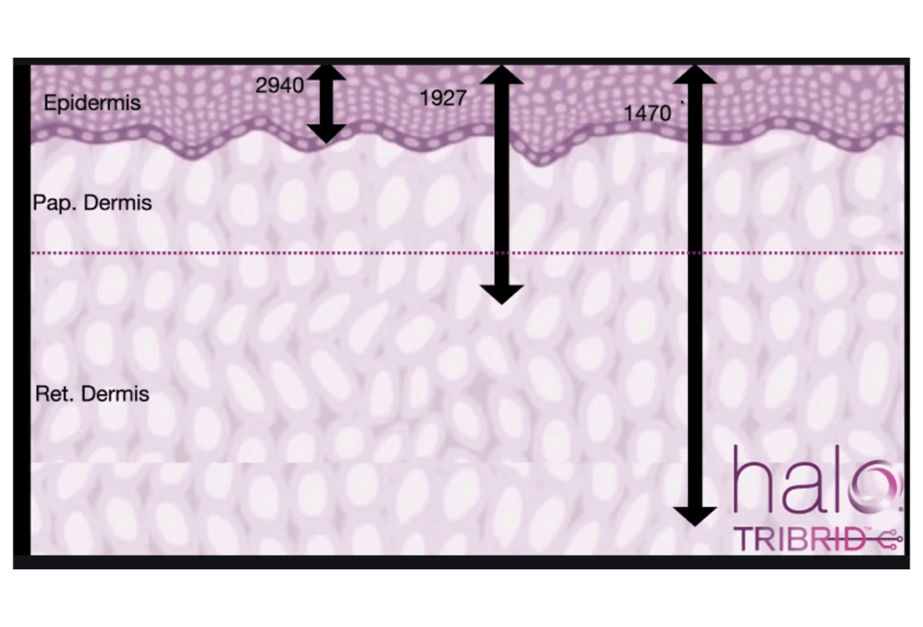 Triple-Wavelength Resurfacing: How HALO TRIBRID Works